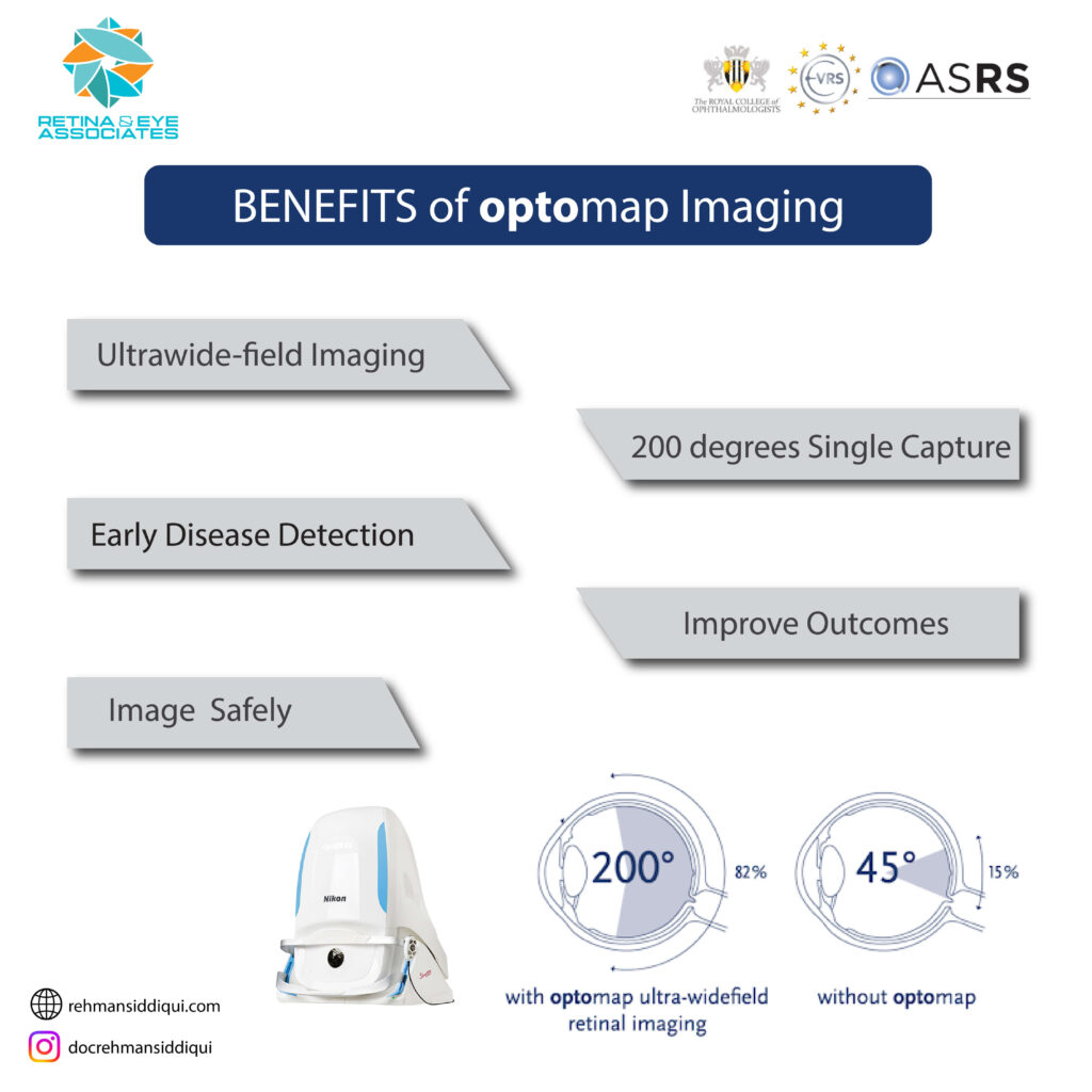 OPTOS Ultra wide field (UWF) Retinal Imaging - RETINA & EYECARE CENTRE